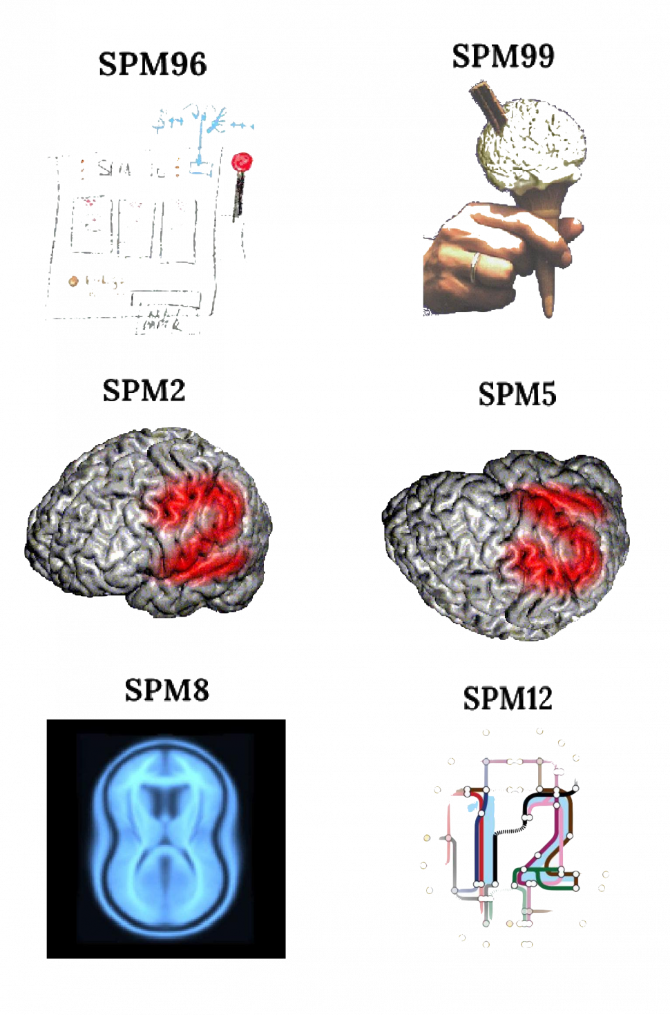 spmimage - Wellcome Centre for Human Neuroimaging | FIL | UCL