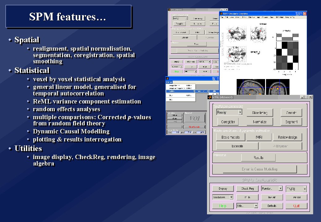 SPM Short Course Slide 6